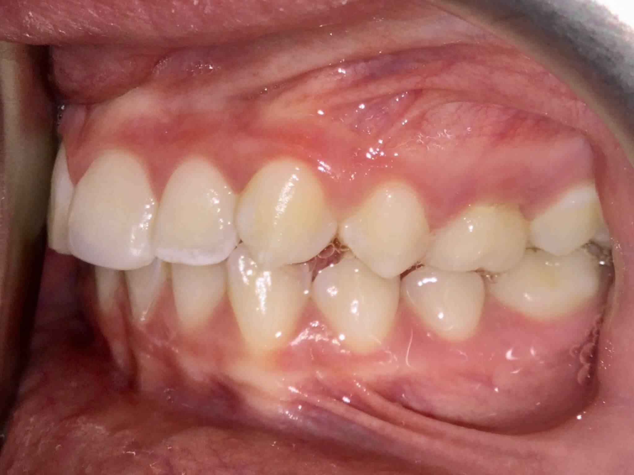 Whetten Orthodontics | Virtual Smile