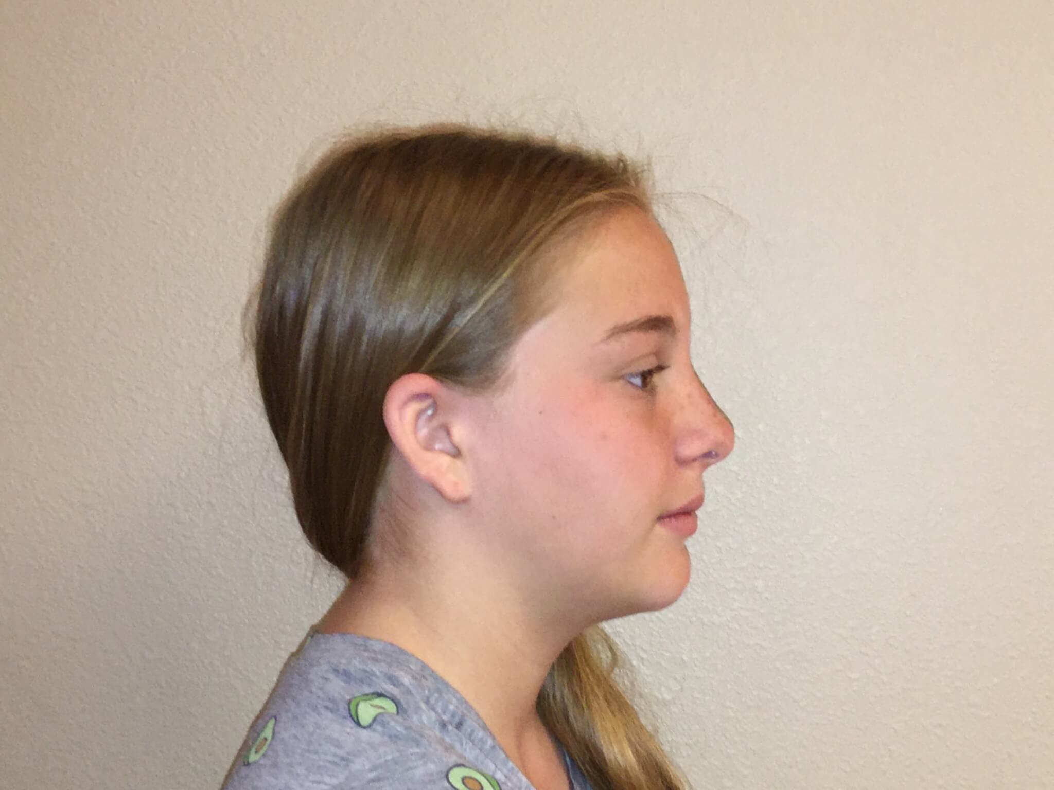 Whetten Orthodontics | Virtual Smile